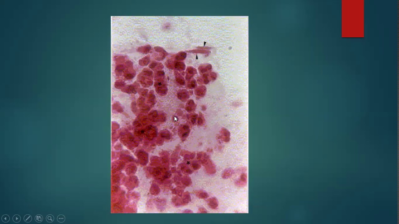 MOCO FECAL 2 1 - YouTube
