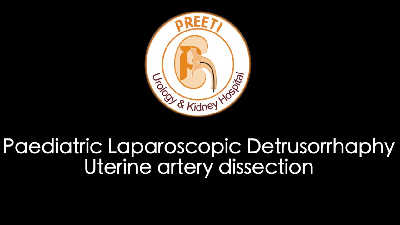 Paediatric Laparoscopic Detrusorrhaphy Uterine artery dissection - YouTube