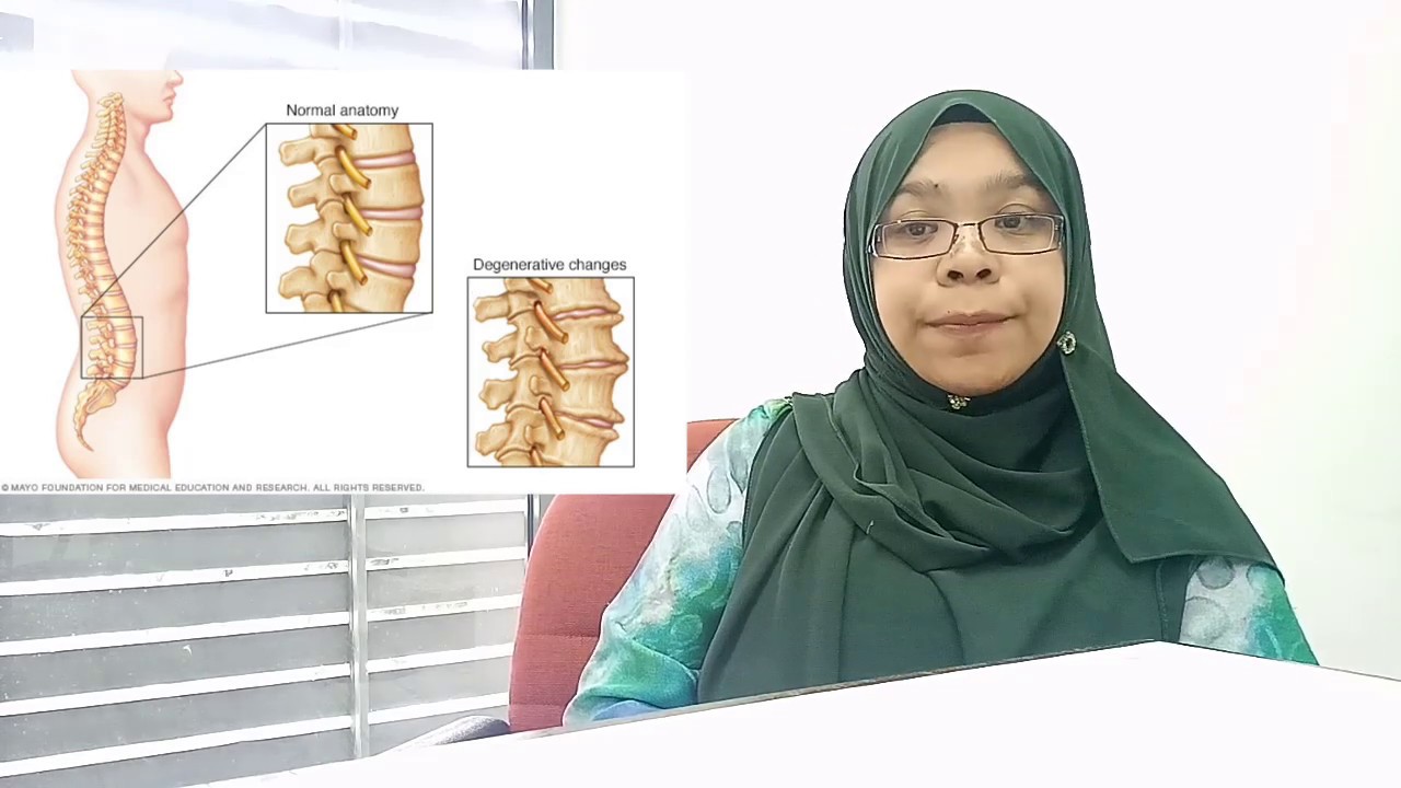 Vitamin Merawat Sakit Saraf Sciatica - YouTube