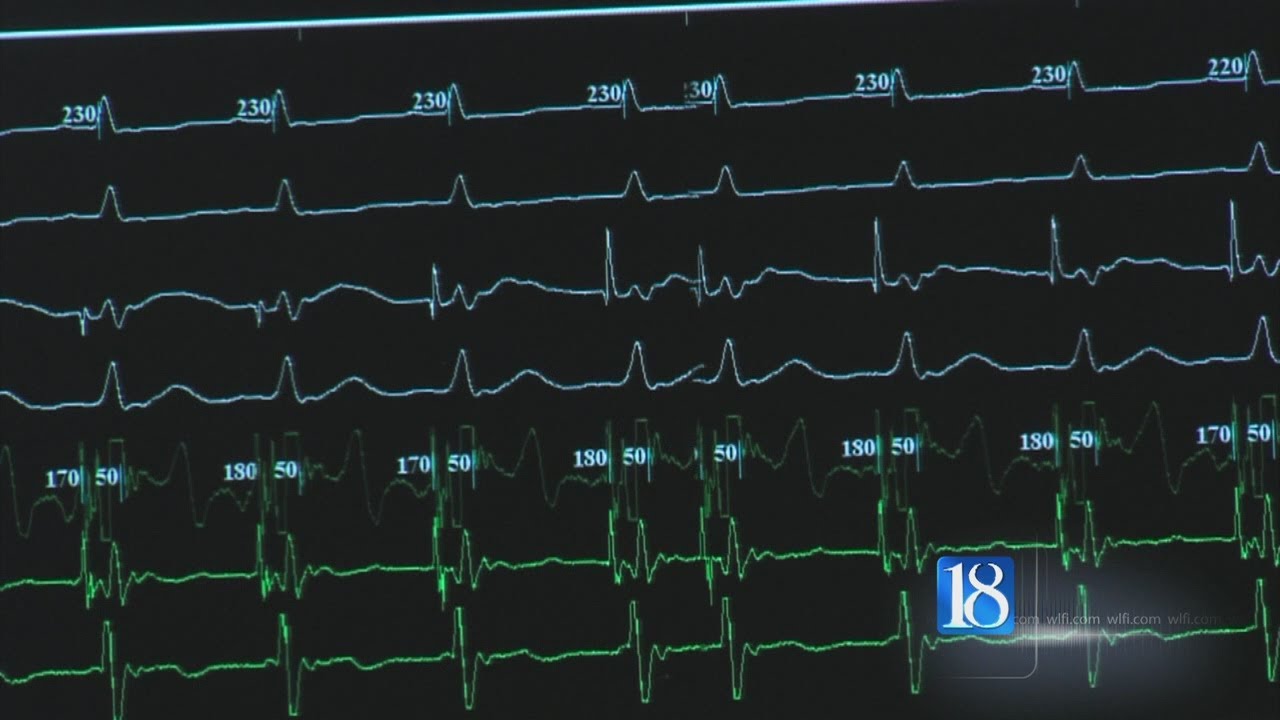 Pacemakers easily solve major problems - YouTube