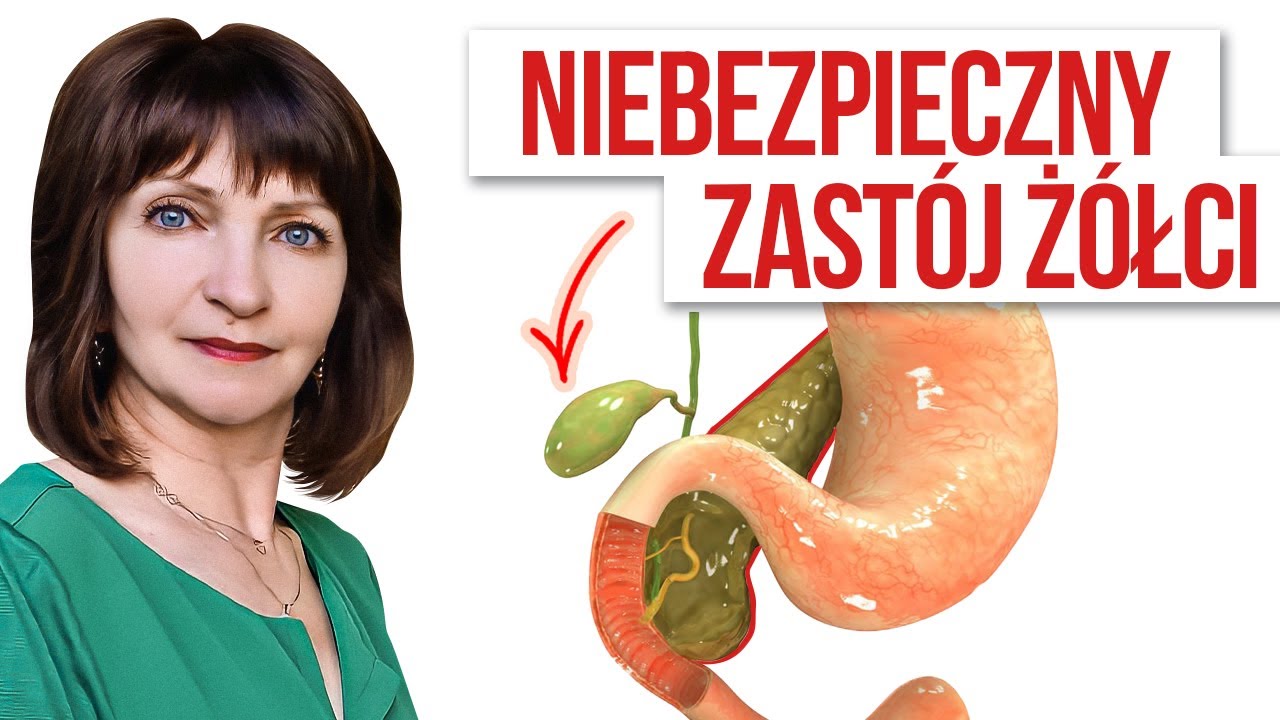 🍀 Jak się pozbyć ZASTOJU ZÓŁCI? Pęcherzyk żółciowy, objawy zastoju ...
