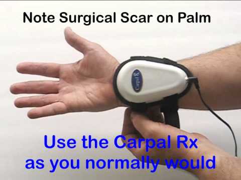 Using the Carpal Rx after carpal tunnel surgery - YouTube