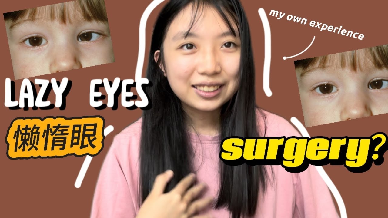 lazy eyes can be solved by surgery? sharing session about lazy eyes懒惰眼 ...