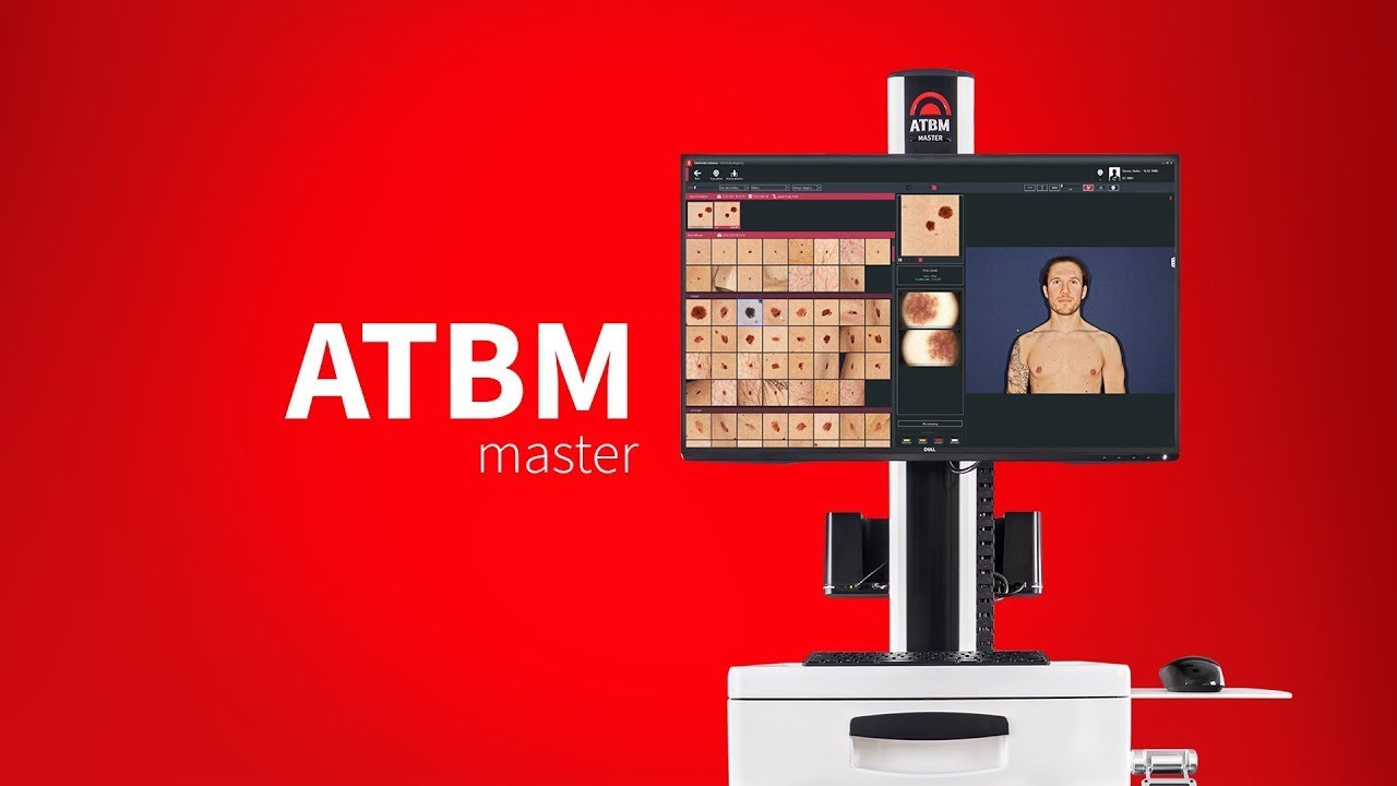 FotoFinder ATBM Master (2021) - YouTube
