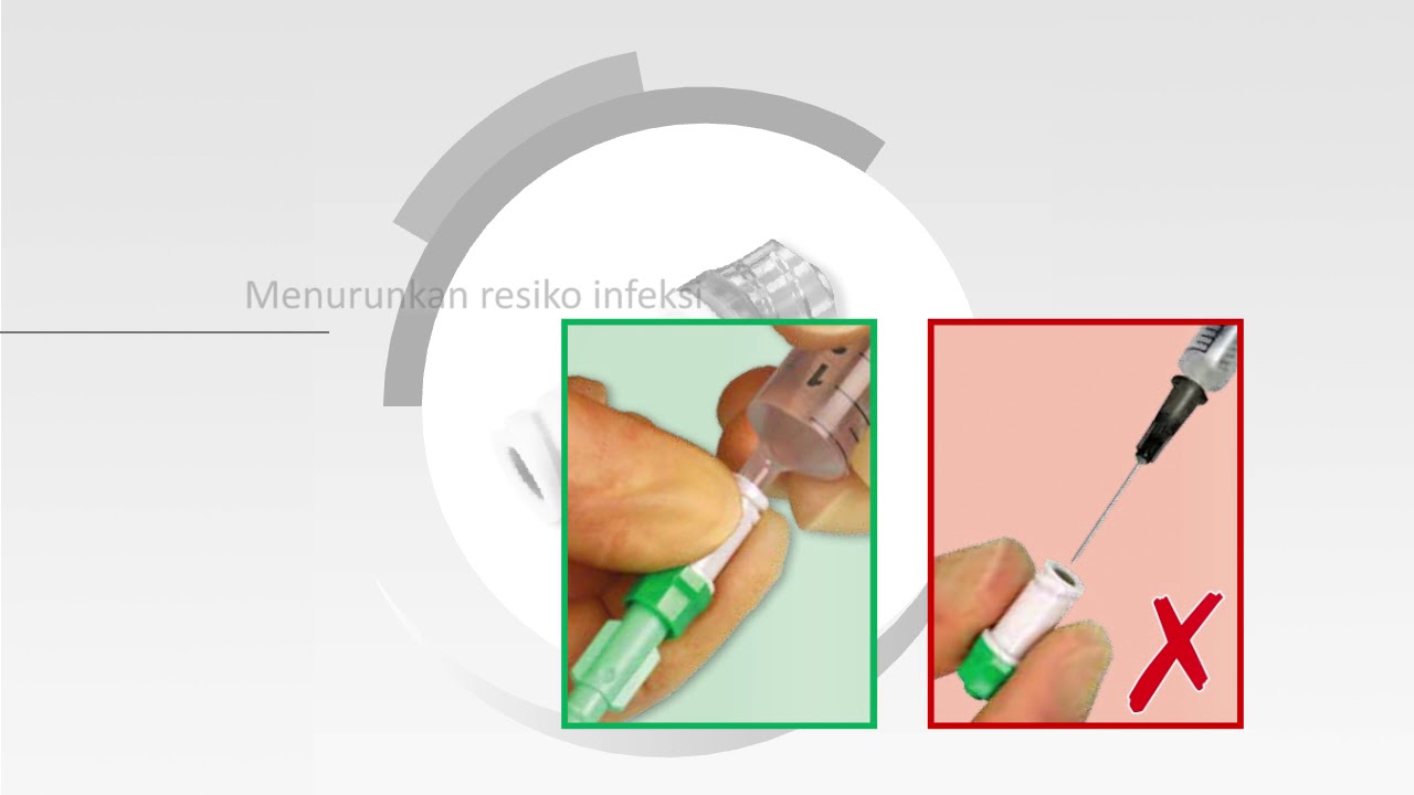 Vygon | Bionector - YouTube