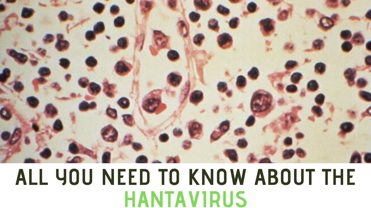 All you need to know about the Hantavirus - YouTube
