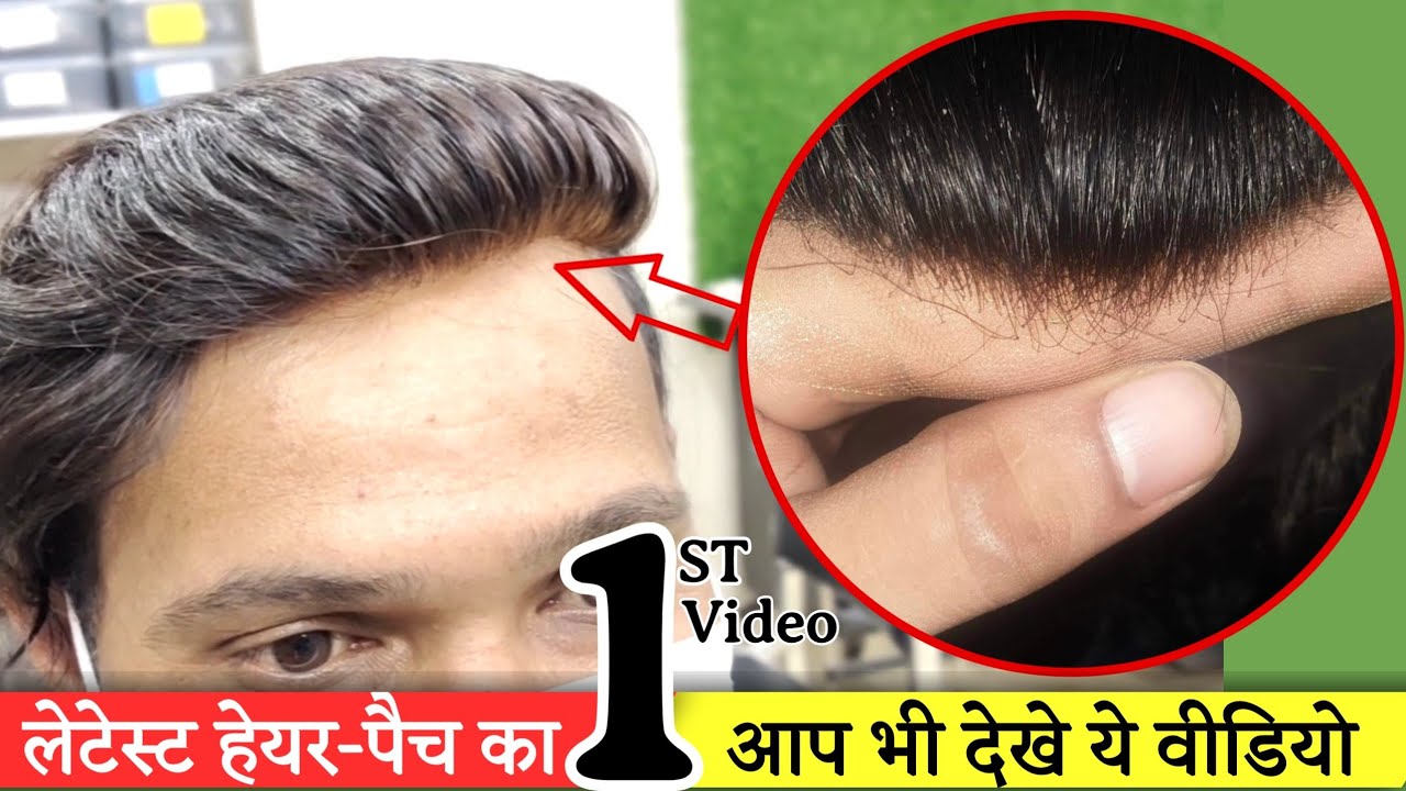 Before & After in Patch | BEST HAIR PATCH IN INDIA |LATEST HAIR PATCH ...