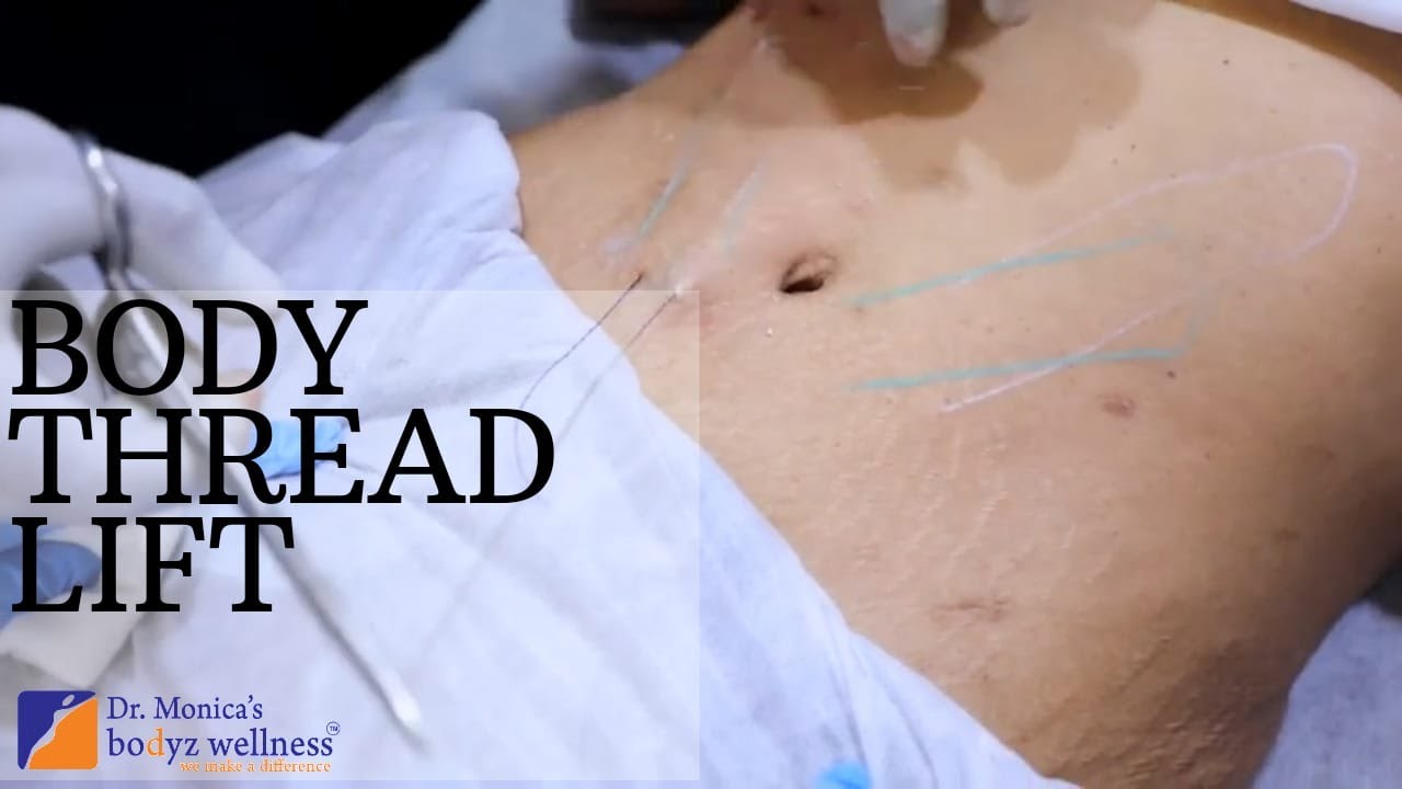 How to get non surgical scar-less tummy tuck? || Dr. Monica Jacob - YouTube