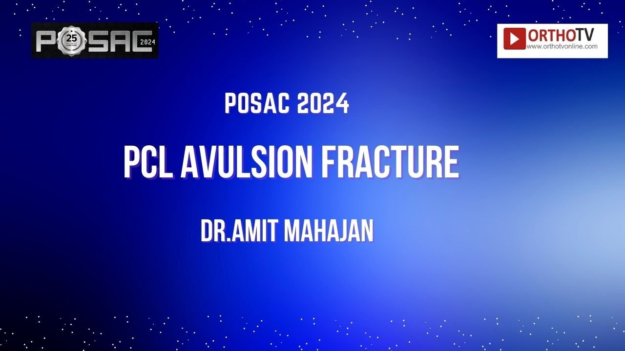 POSAC 2024 : PCL avulsion fracture - Dr.Amit Mahajan - YouTube