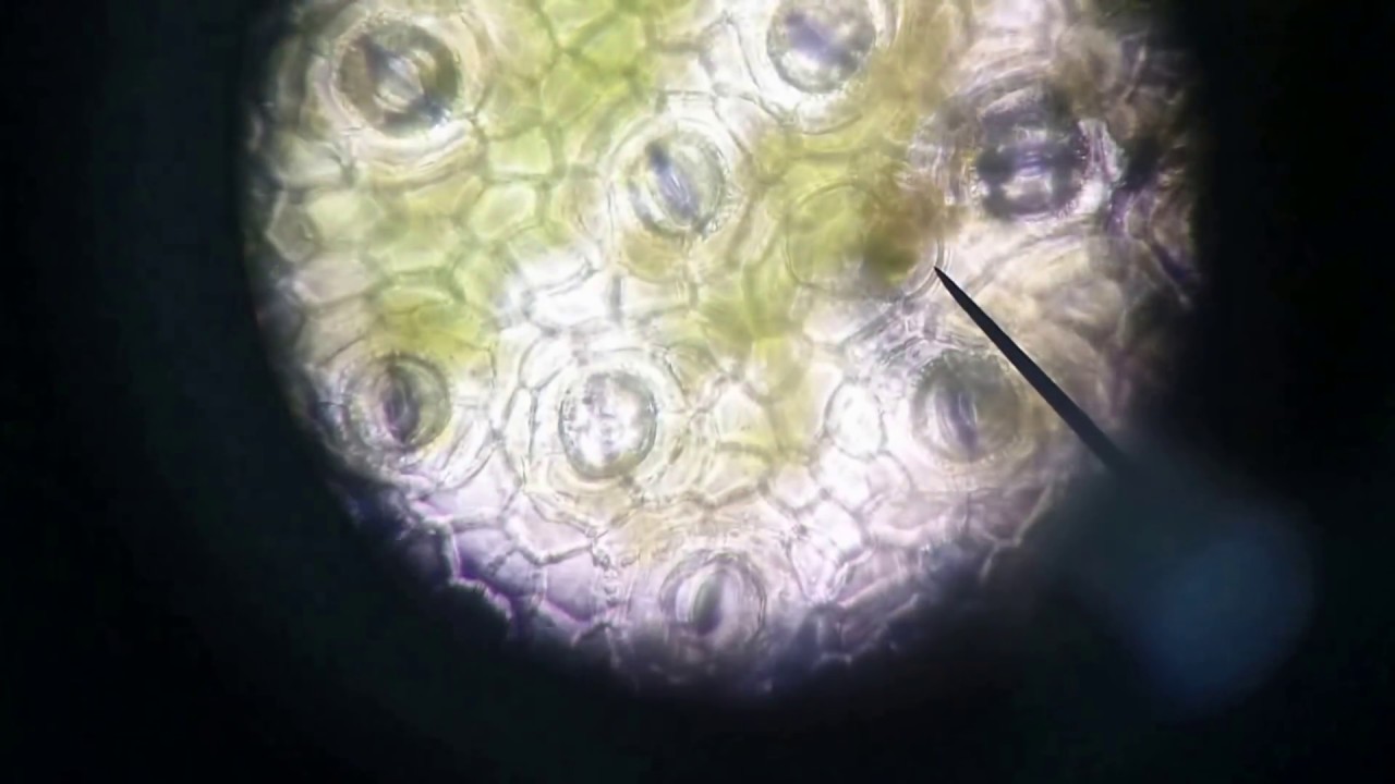 ficus elastica how is seen under the microspe (kaucuk bitkisi mikroskop ...