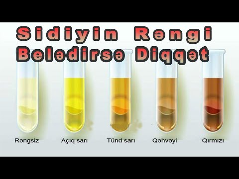 Sidiyin rəngi bu xəstəliklərə işarə edir