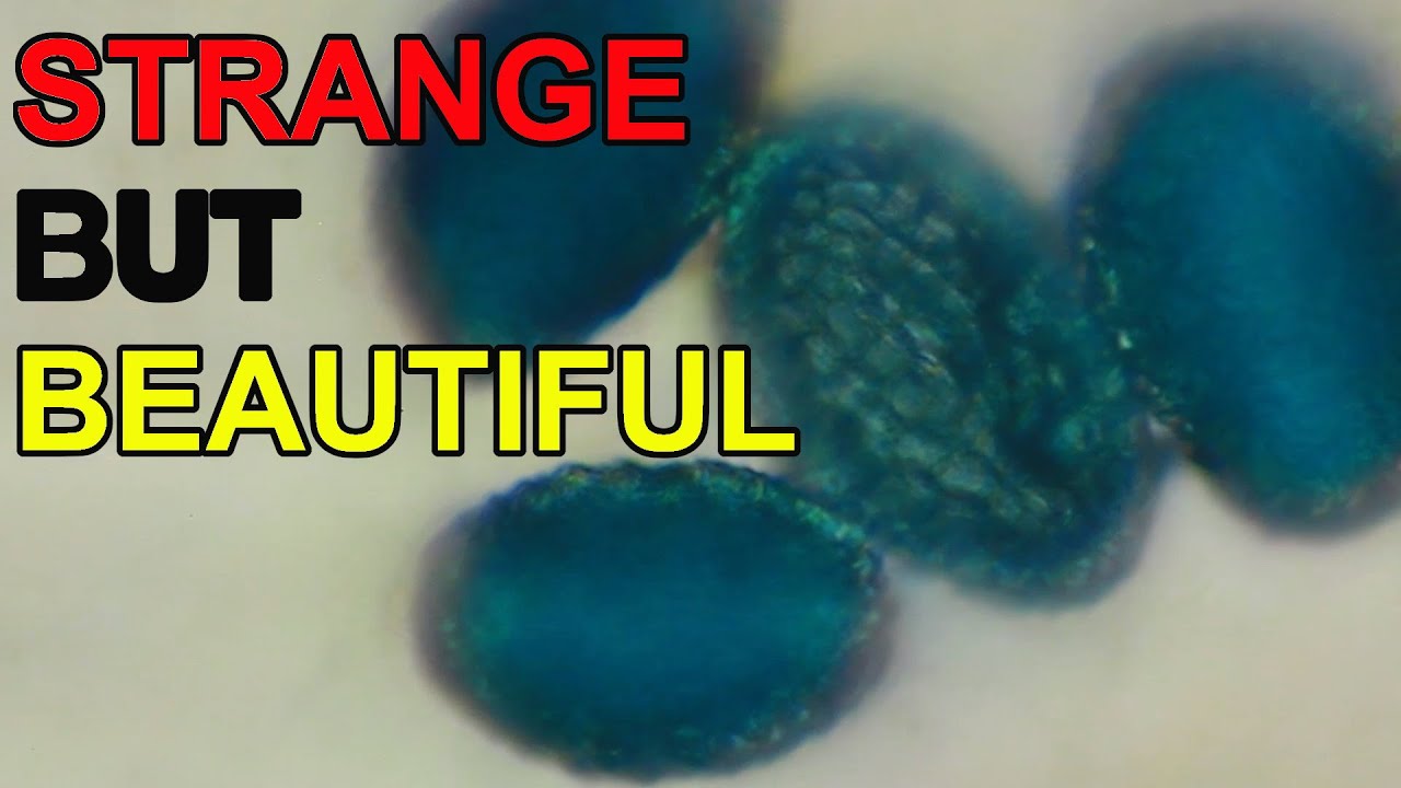Tulip Pollen is WONDROUS under the microscope - YouTube