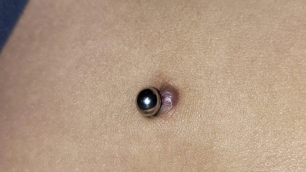 How To Get Rid Of Piercing Bump On Belly YouTube how-to-get-rid-of-piercing-bump-on-belly-youtube