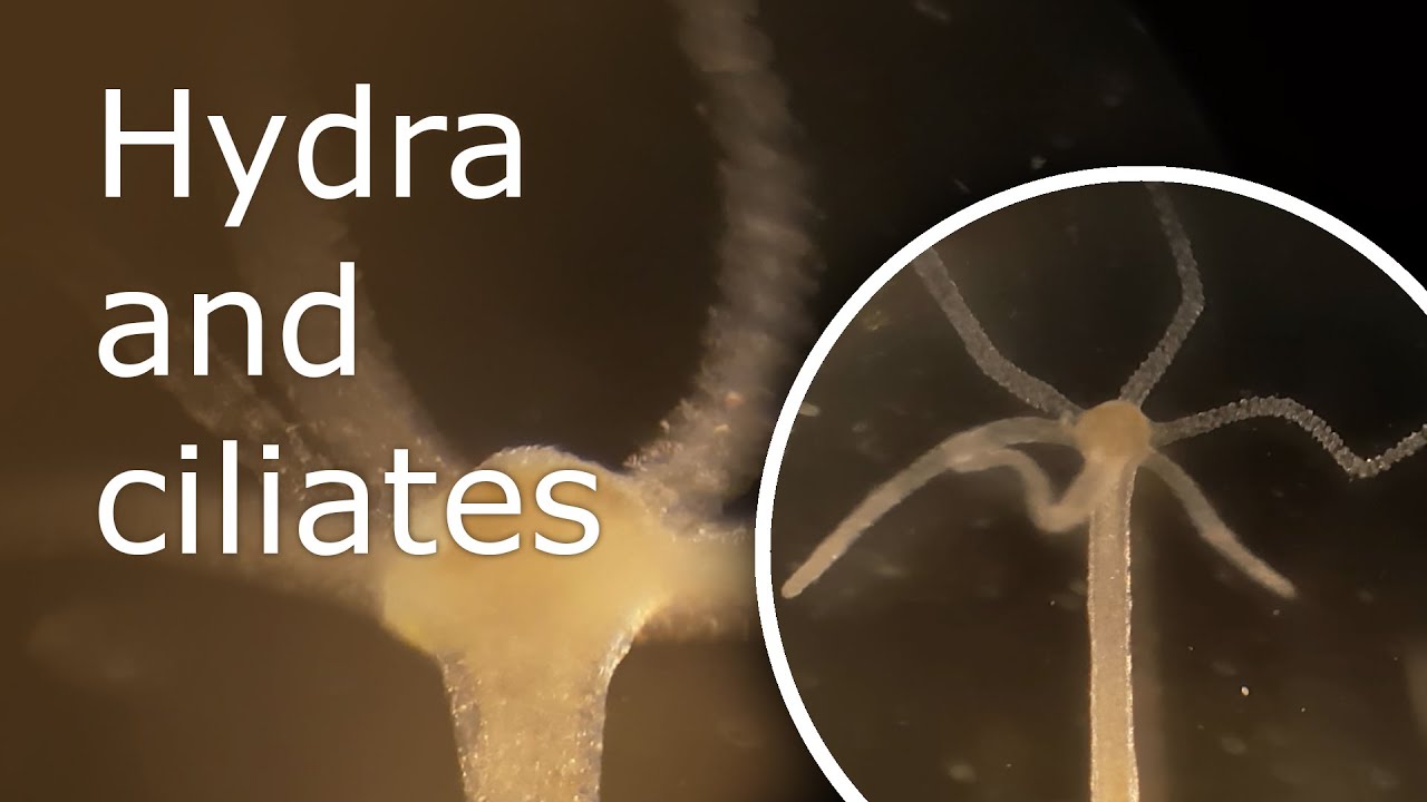 Hydra Under Microscope 40x