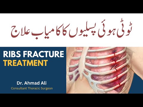 Ribs Fracture Treatment | Tuti Hui Pasli Ka Ilaj | Broken Ribs Pain In Urdu