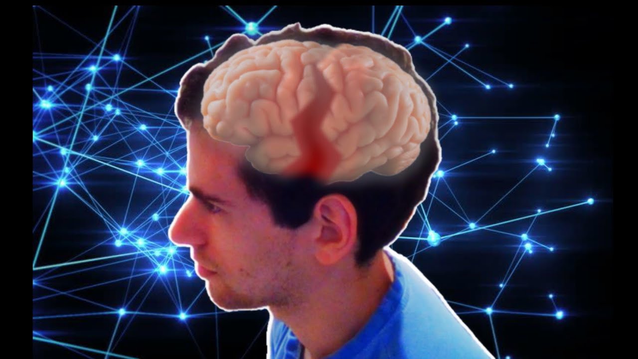 What is a Lobotomy and Should you get one? - YouTube