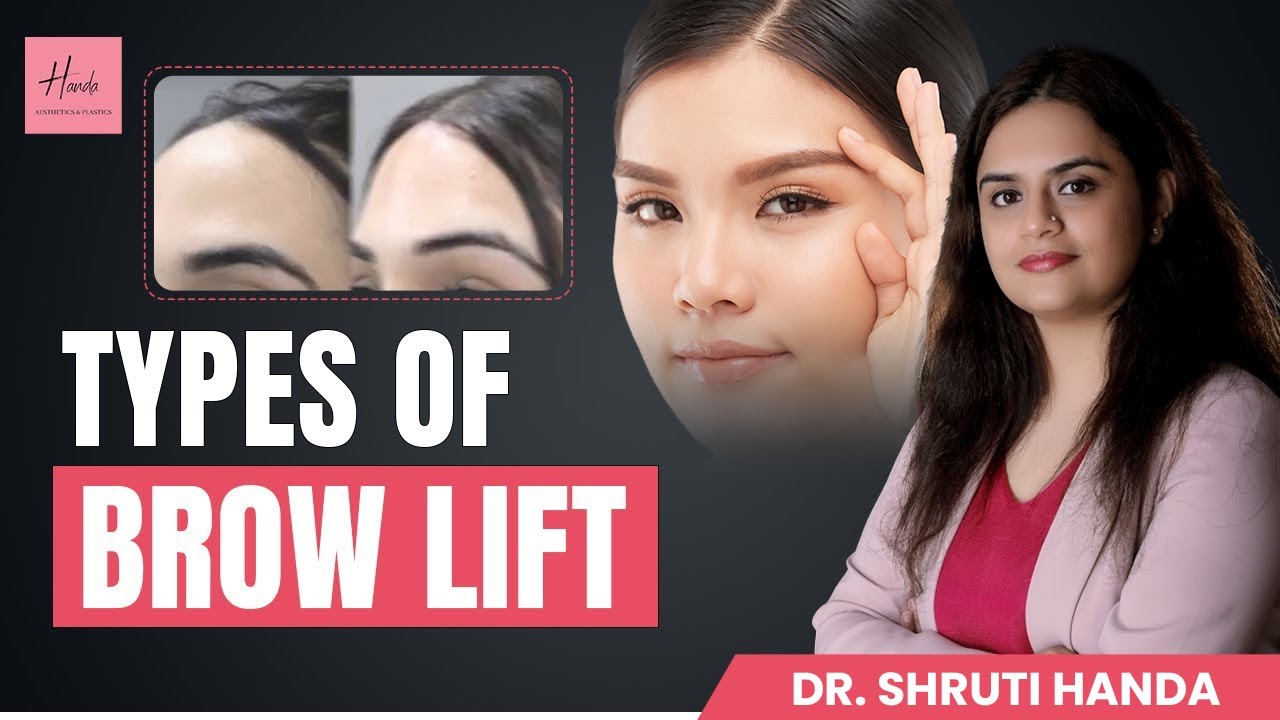 Types of Brow Lift | Temporal, Endoscopic, Anterior, Standard, Fox Eye ...