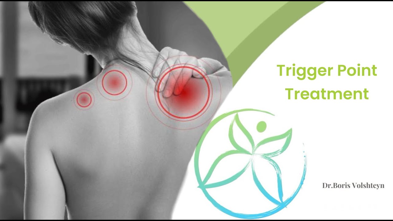 Trigger Point Treatment- Dr. Boris Volshteyn - YouTube