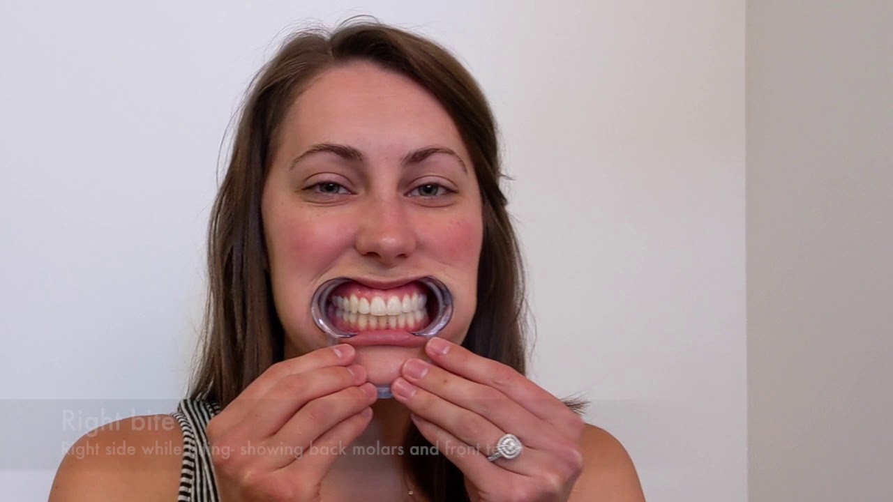 Virtual Visits! How to take your pictures! | Paschal Orthodontics ...