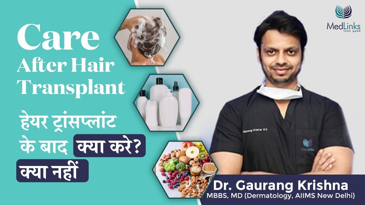 {Day 1-5} हेयर ट्रांसप्लांट के बाद क्या करे? Care After Hair Transplant ...