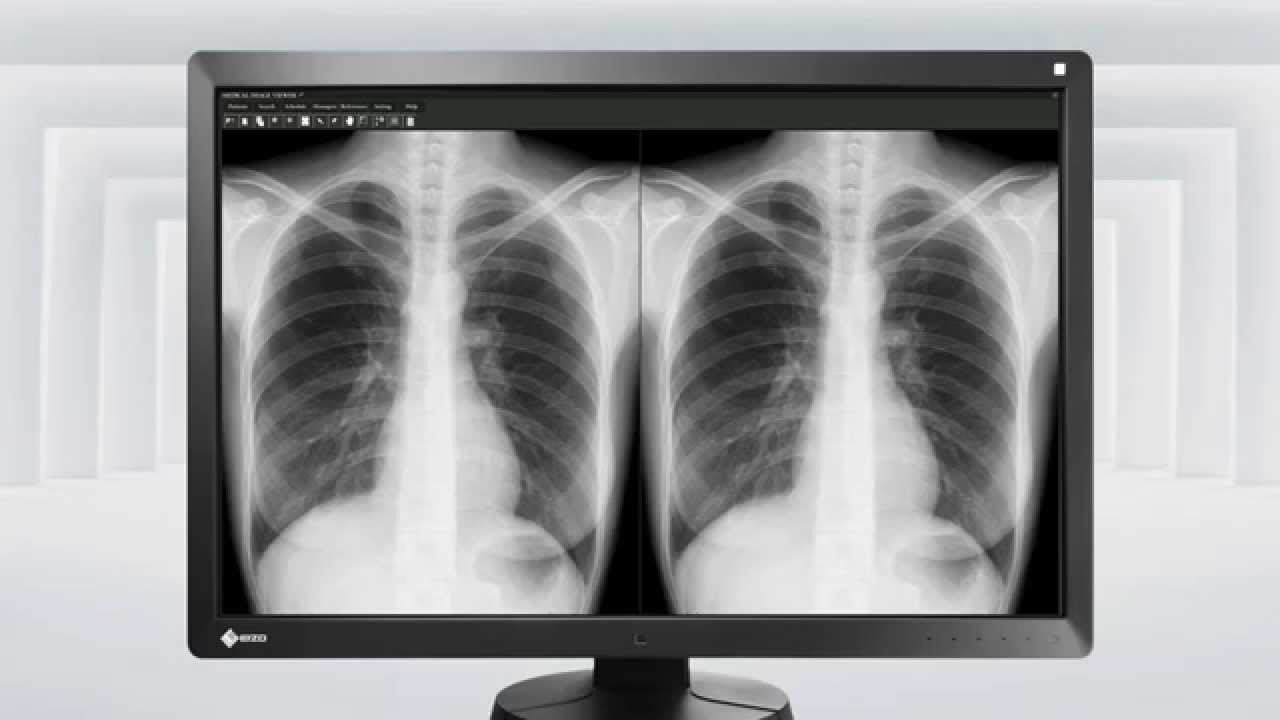 RadiForce RX650 EIZO Medical Multi Modality Monitors - YouTube