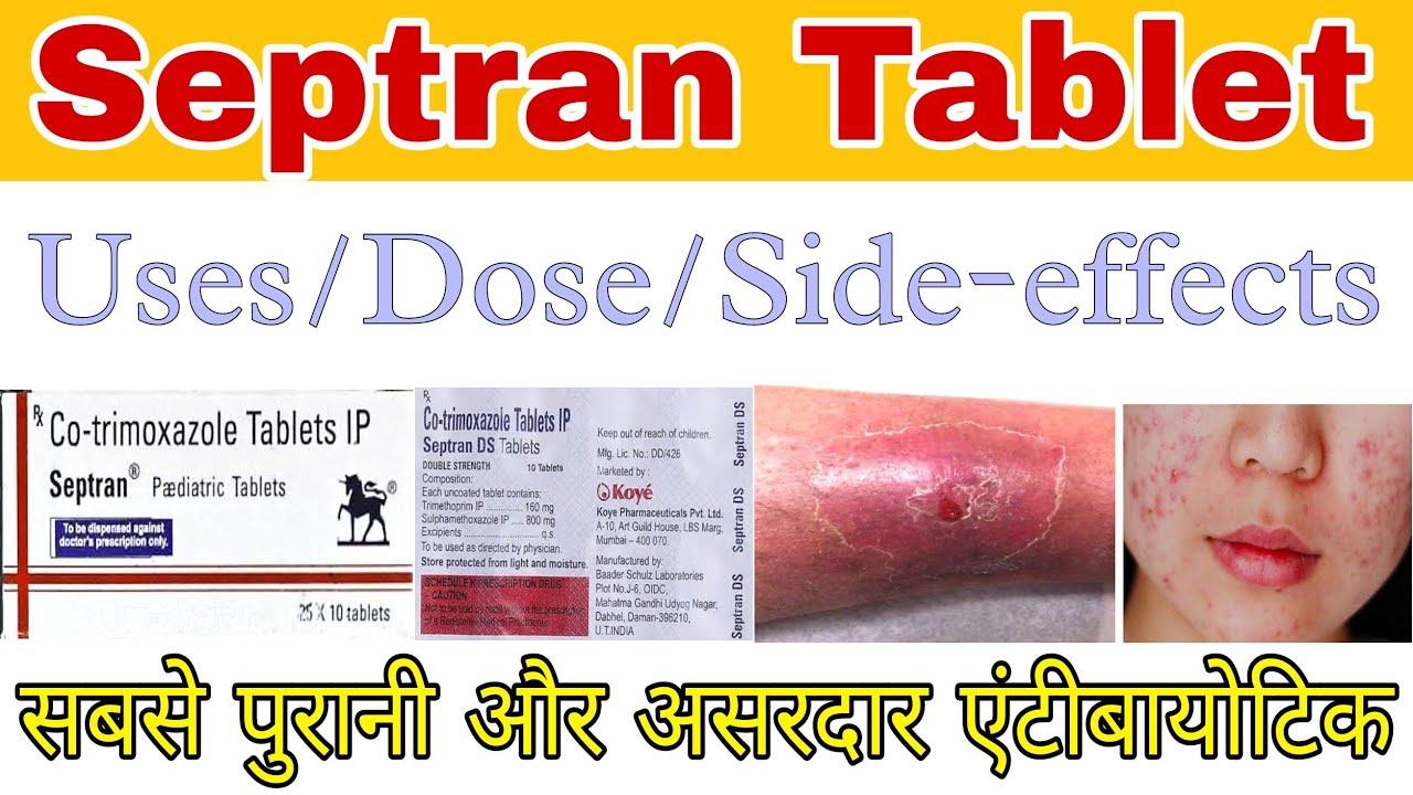 Septran tablet Uses/Dose/Side-effects | Cotrimoxazole tablet | Septran ...