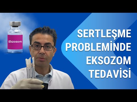 Sertleşme Probleminde Eksozom Nedir? Eksozom Tedavisi Nasıl Yapılır?