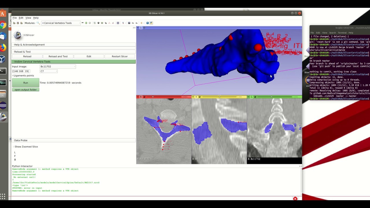 SlicerCervicalSpine - YouTube