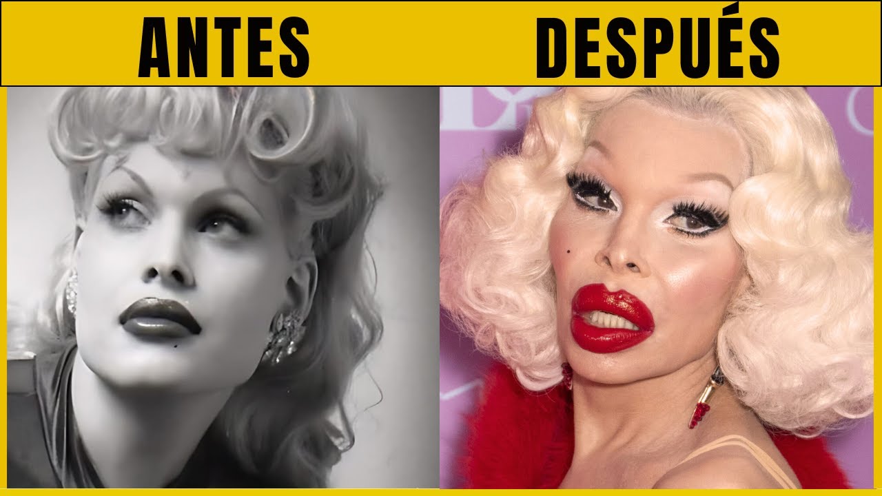 50 FAMOSOS IRRECONOCIBLES después de la CIRUGÍA ESTÉTICA - YouTube