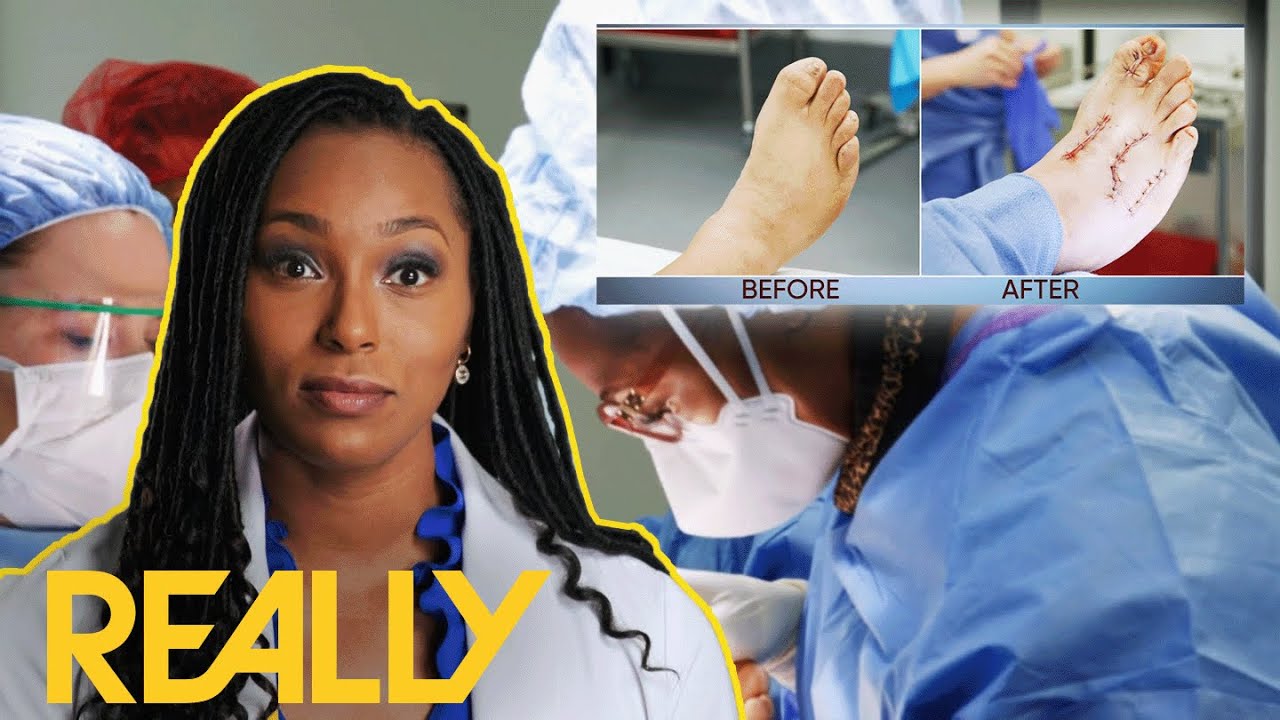Dr Ebonie Spends 7 HOUR Surgery On A Foot With Almost All Bones Broken | My Feet Are Killing Me ...