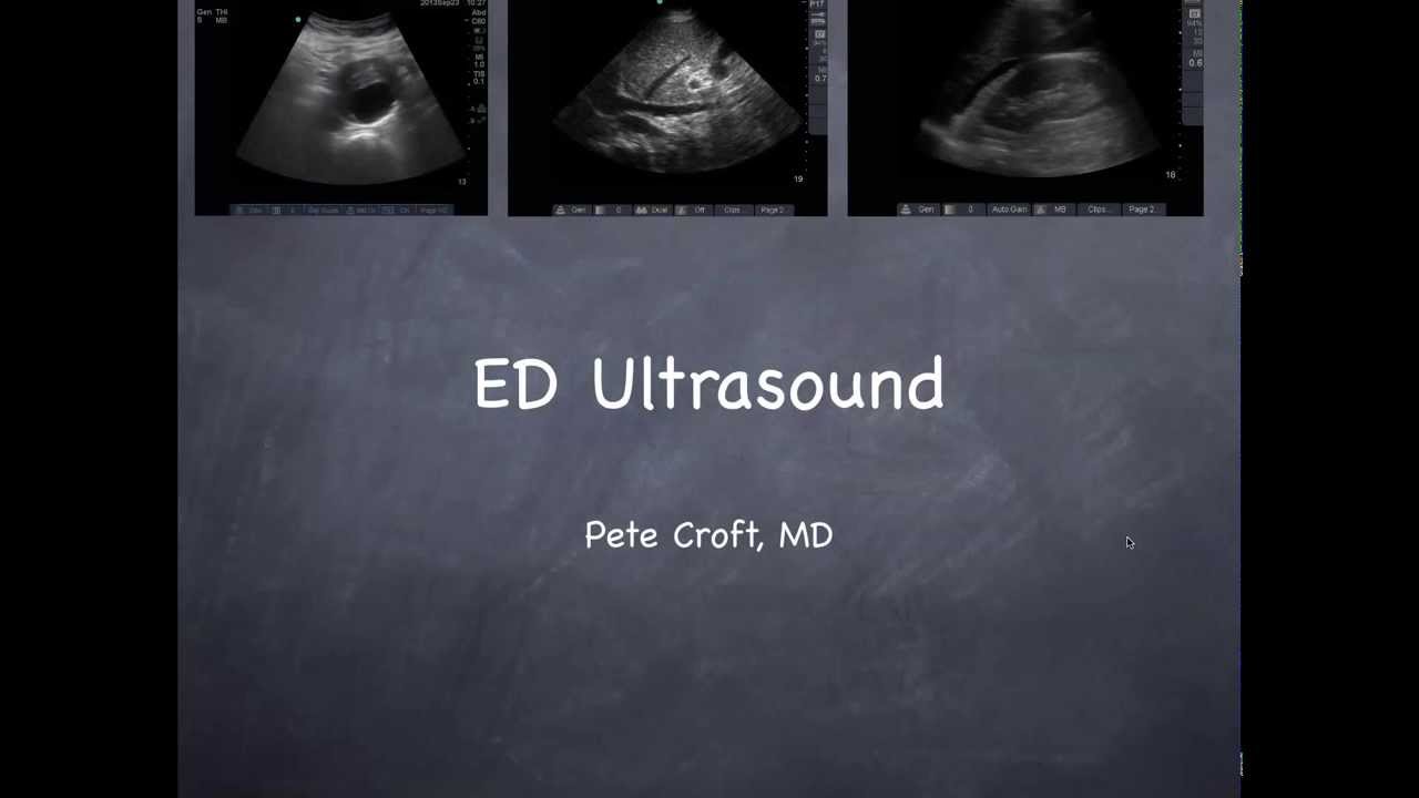 Introduction to ultrasound tutorials - YouTube