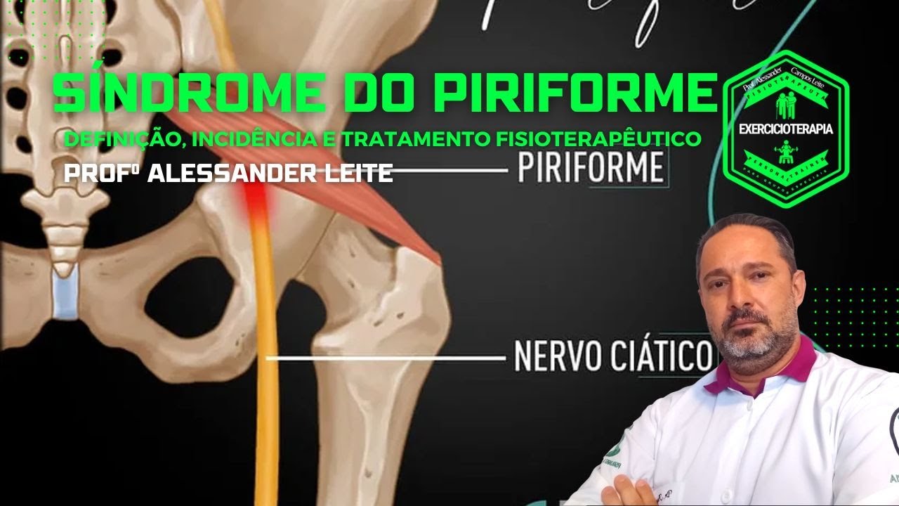 Injecao De Sindrome Do Piriforme