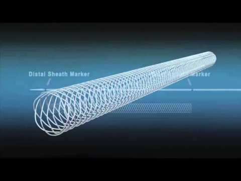 Supera Deployment Animation - YouTube