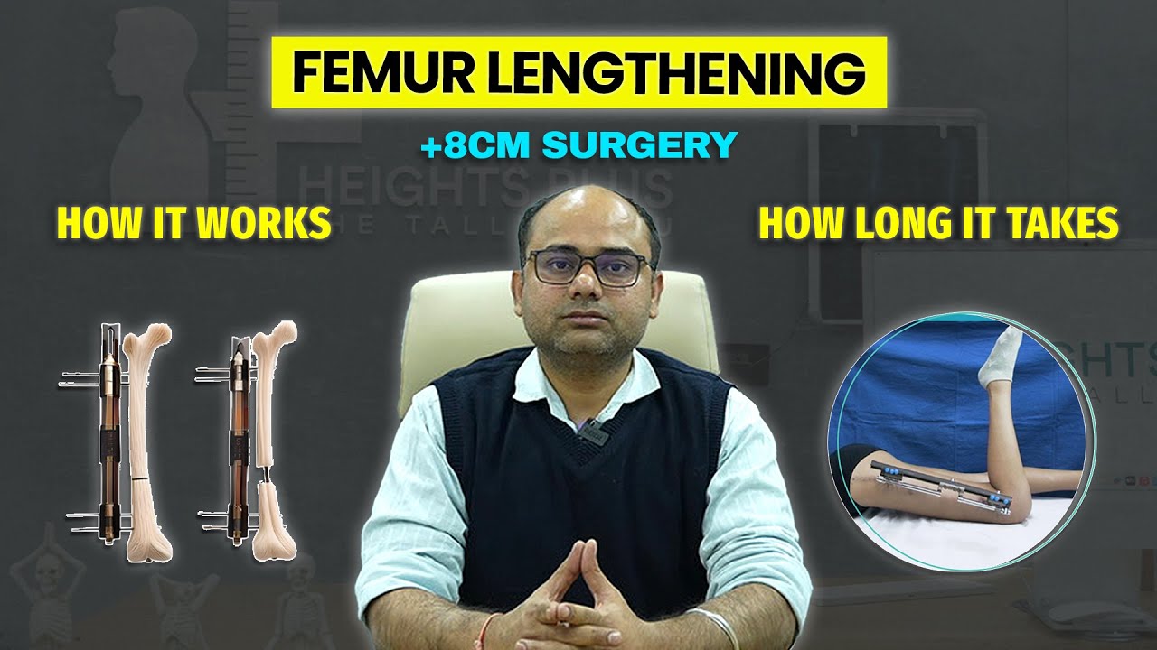 Doctor Explains Femur Lengthening (+8 CM) | How Height Increase Surgery ...