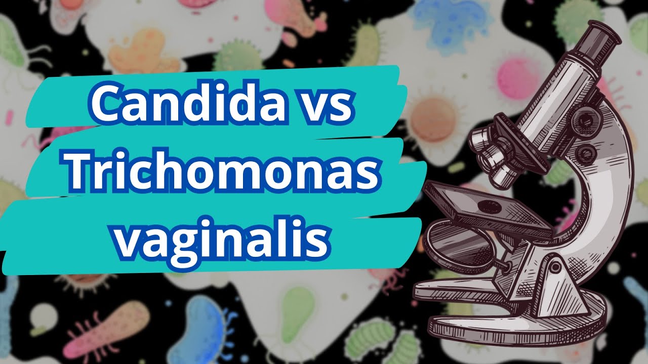 Candida versus Trichomonas vaginalis - YouTube