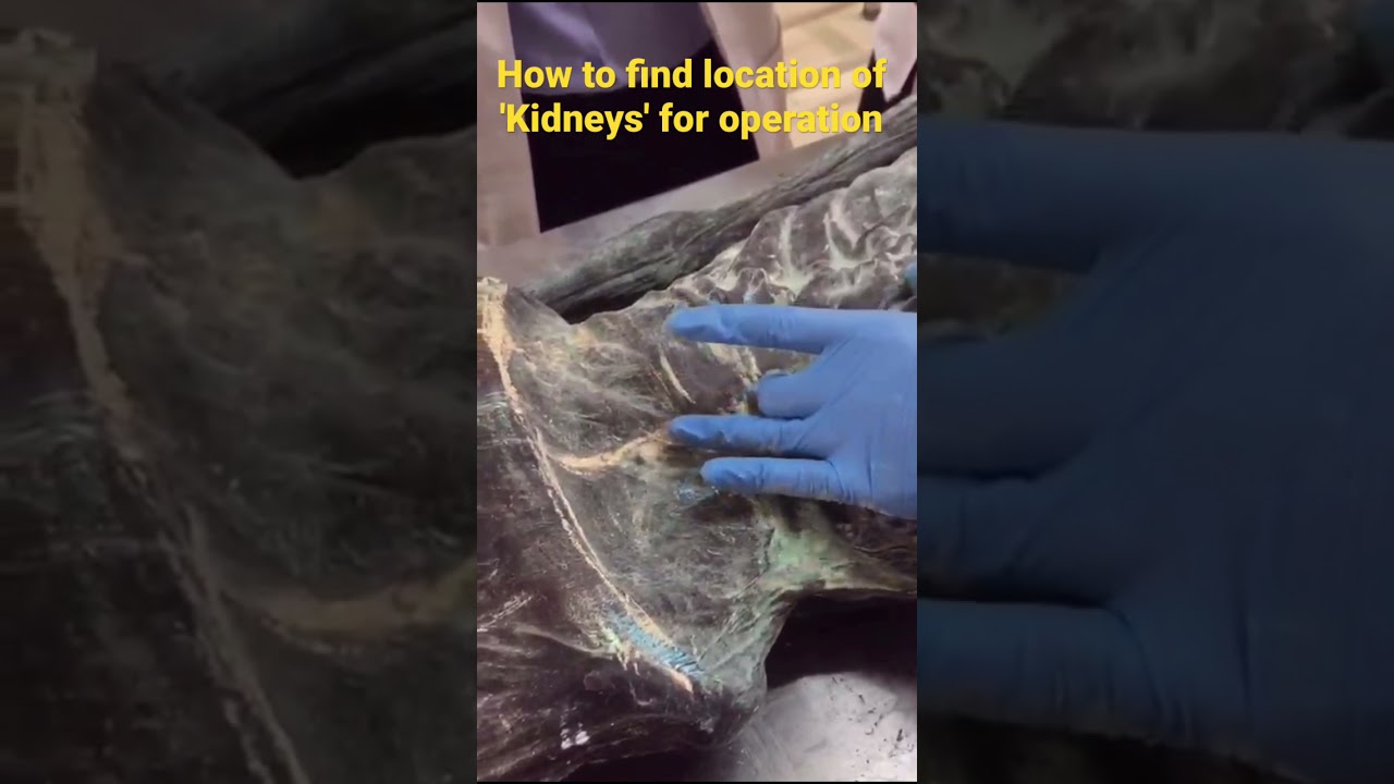 How To Find Exact Location Of Kidneys In Human Body For Operation How To Find Exact Location Of Kidneys In Human Body For Operation