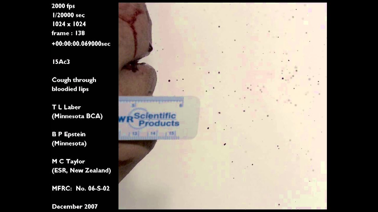Cough through bloodied lips | Blood Spatter Analysis - YouTube