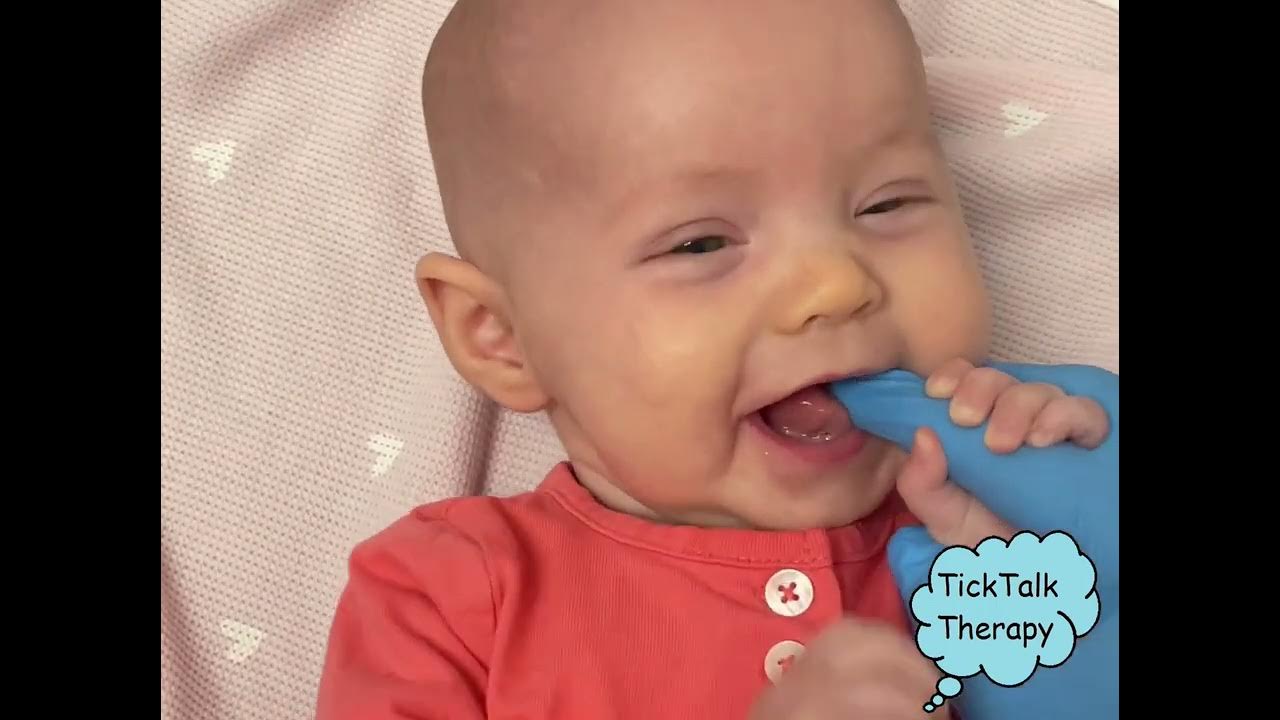 Infant Suck Training and Oral Exercises Post Frenectomy - YouTube