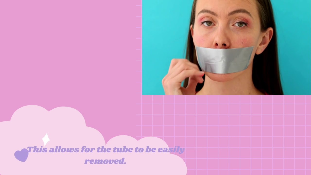 How to remove NG tube - YouTube