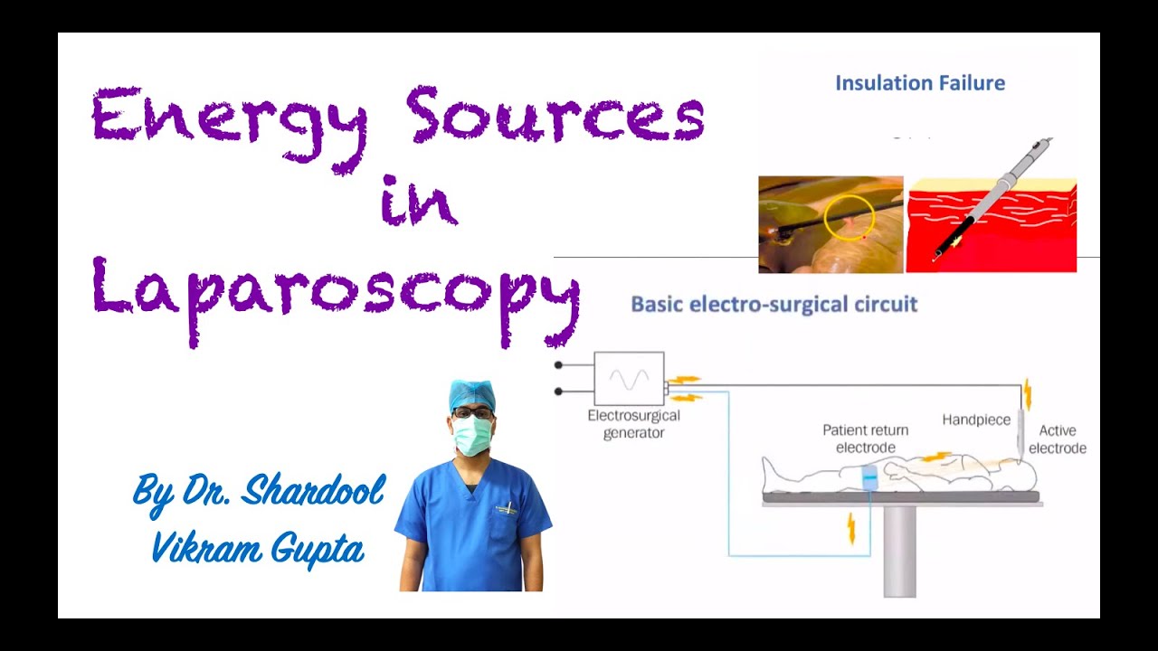 Energy Sources in Laparoscopy - YouTube