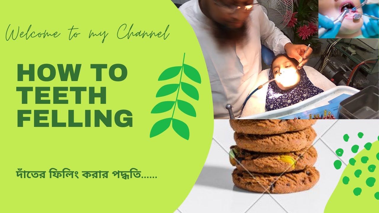 Teeth Filing for child - কিভাবে দাঁতের ফিলিং করে। by Azad360 Vlogs ...