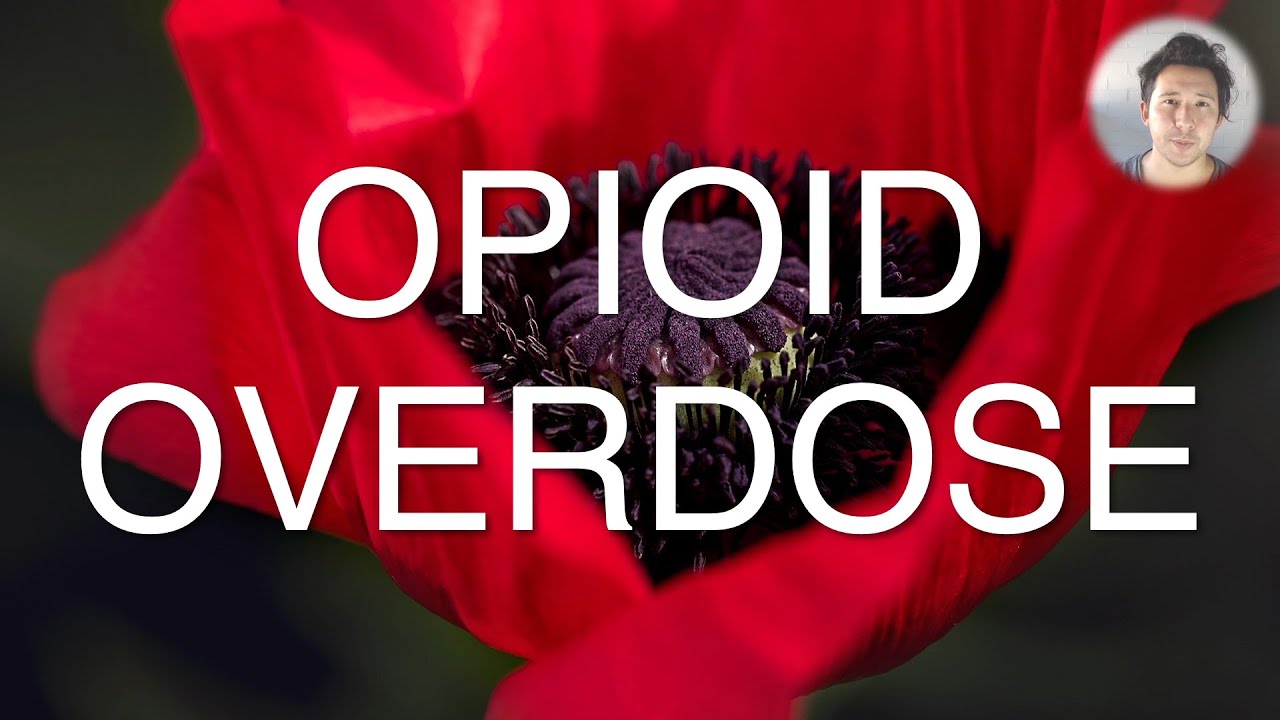 Opioid overdose: Risk assessment and features - YouTube