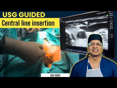 Ultrasound guided Central Line insertion. For best results NEVER ignore ...