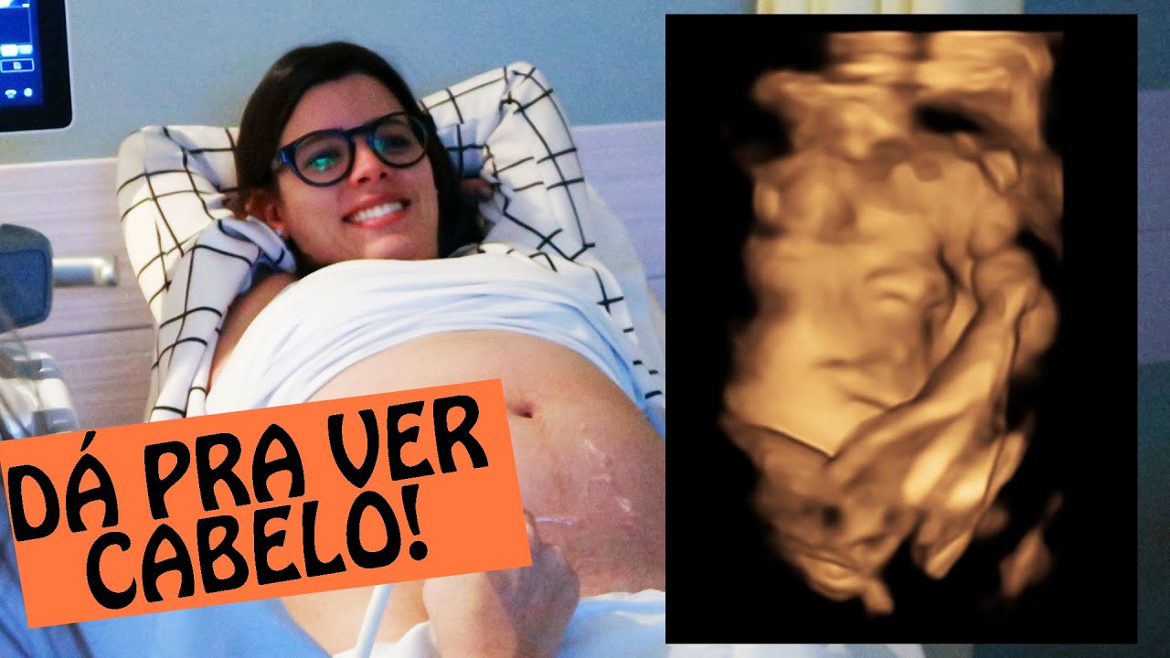 ÚLTIMO ULTRASSOM ANTES DO PARTO - #BabyTPM | TPM por Ju Ferraz - YouTube