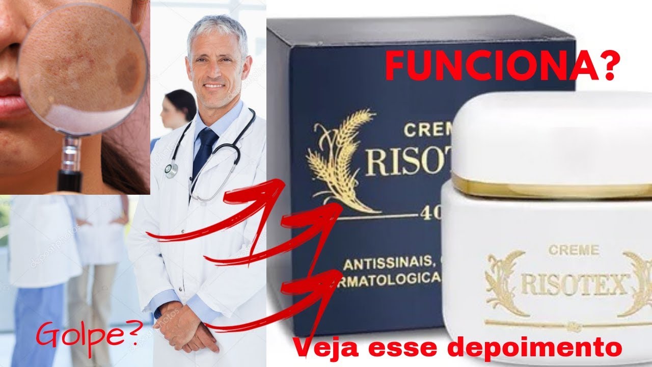 Creme risotex funciona? Como comprar e usar risotex? Depoimento de quem ...