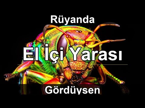 Rüyada El İçi Yarası Görmek Ne Anlama Gelir?