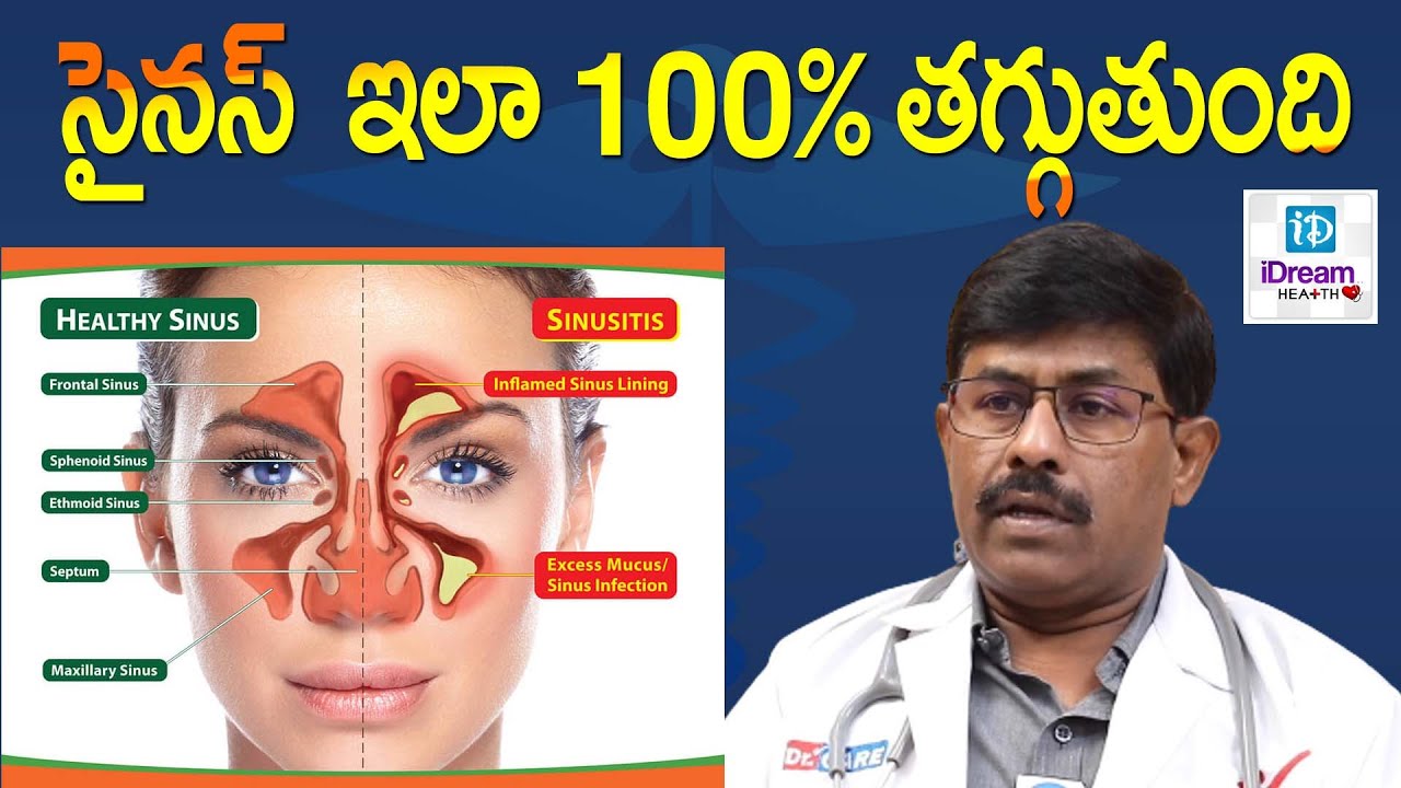 How to Control Sinus at Home Very Fast | Sinuses Homeopathy Treatment ...