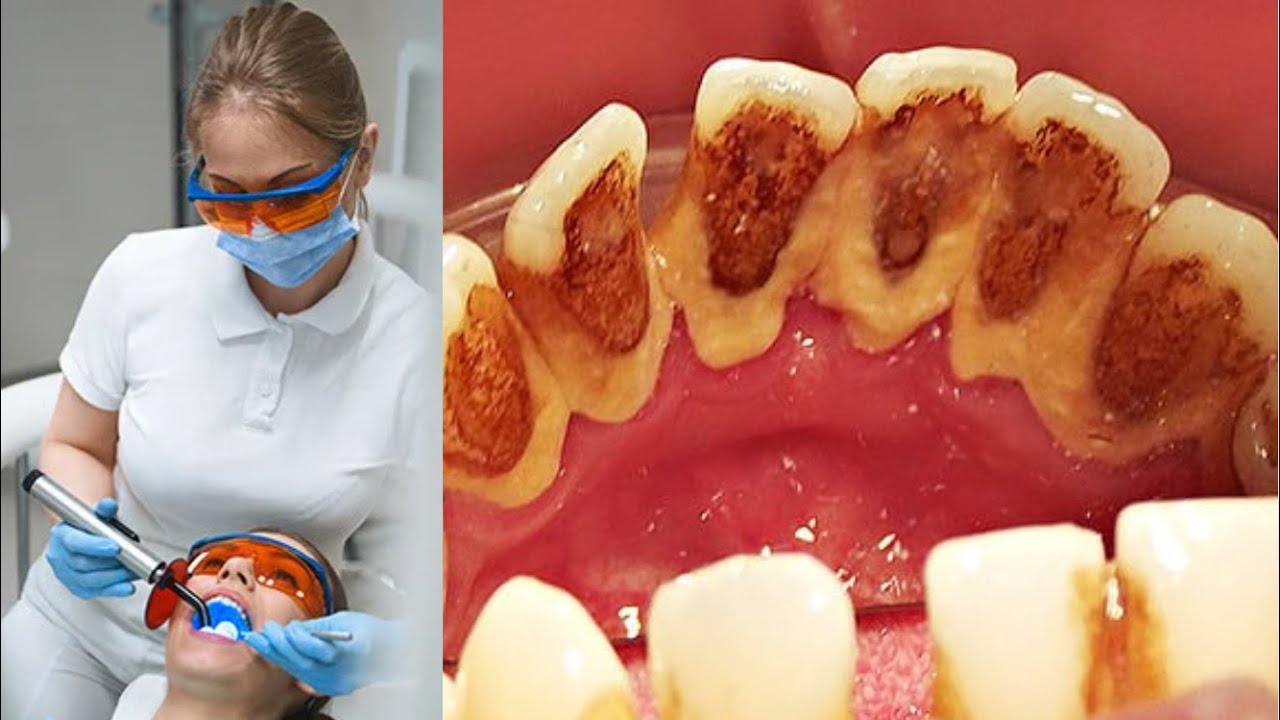 Exploring a Tooth Under a Microscope - Dental Science Revealed - YouTube