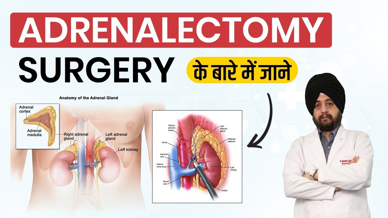 Adrenalectomy Surgery In Hindi Adrenal Gland Tumor Removal adrenalectomy-surgery-in-hindi-adrenal-gland-tumor-removal