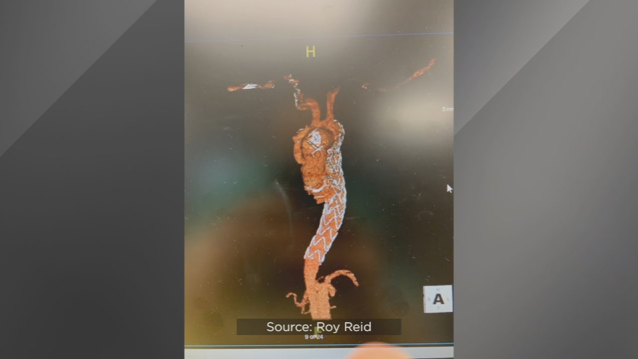 ‘Like someone had punched a hole in my chest’: Central Florida man ...